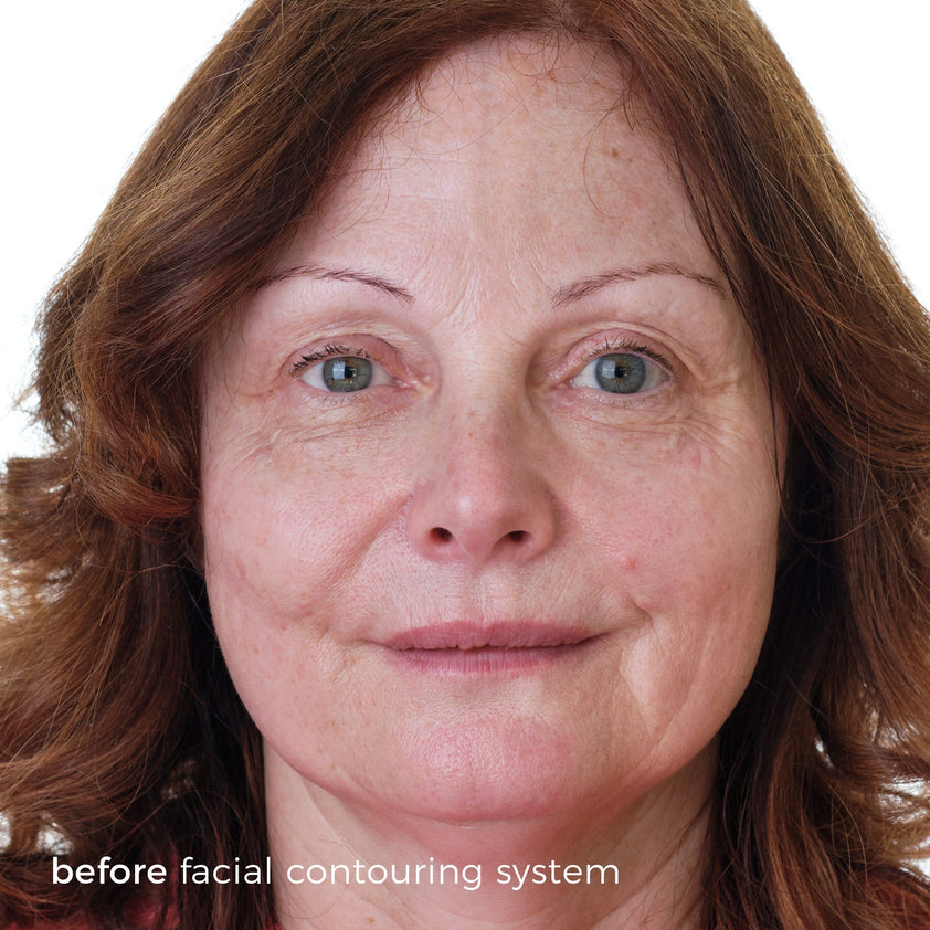 skinbunny's under eye enhancer with our facial contouring system absol ...