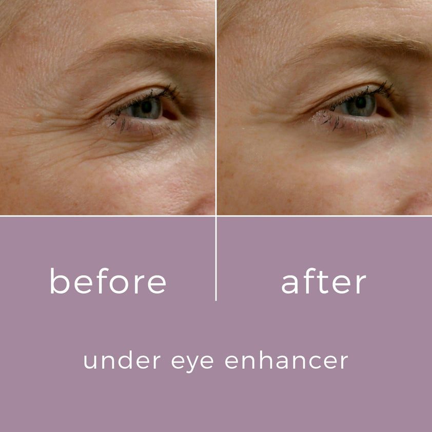 Skinbunny Under Eye Enhancer – Skin Bunny UK